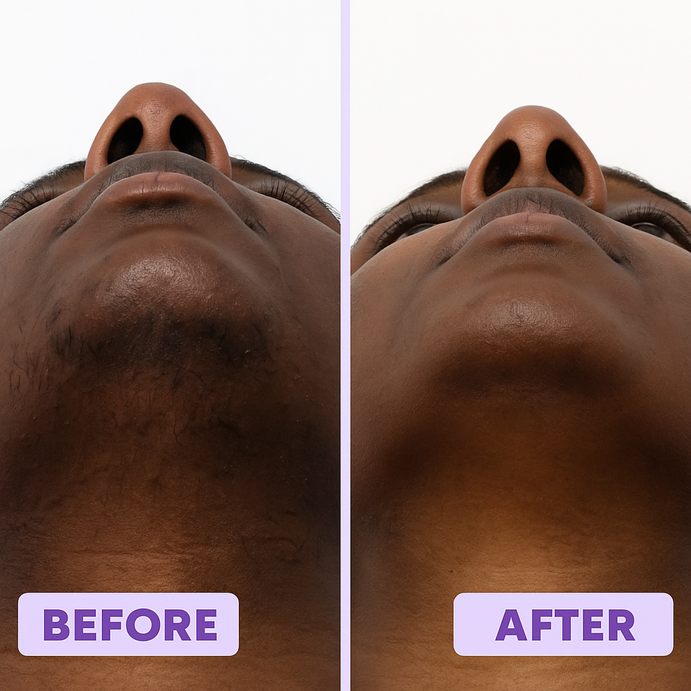 Facial Hair Removal Cream – hydrateology